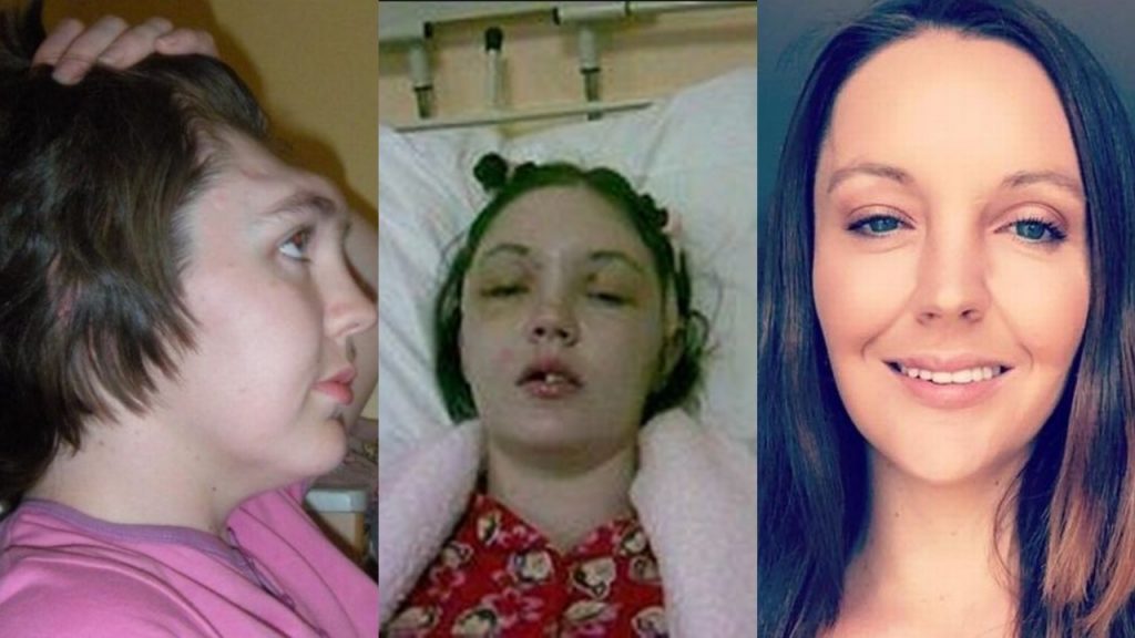 Young Woman Left Without A Forehead