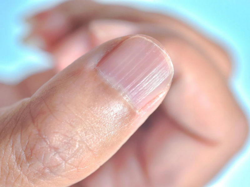 Your Fingernails Are Showing Your Age. Here’s What To Do.